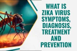 What Is Zika Virus: Symptoms, Diagnosis, Treatment, And Prevention