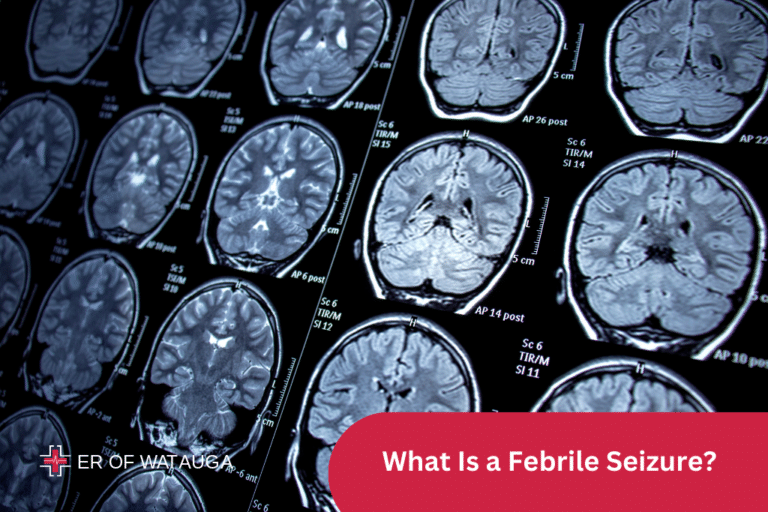 Febrile Seizures: Types, Symptoms, Causes, And Treatment